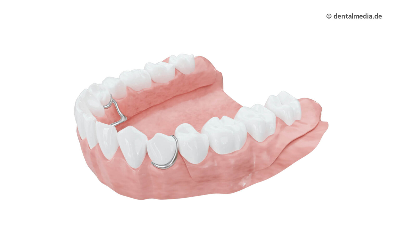 Zahnersatz | Ulrike Schneider